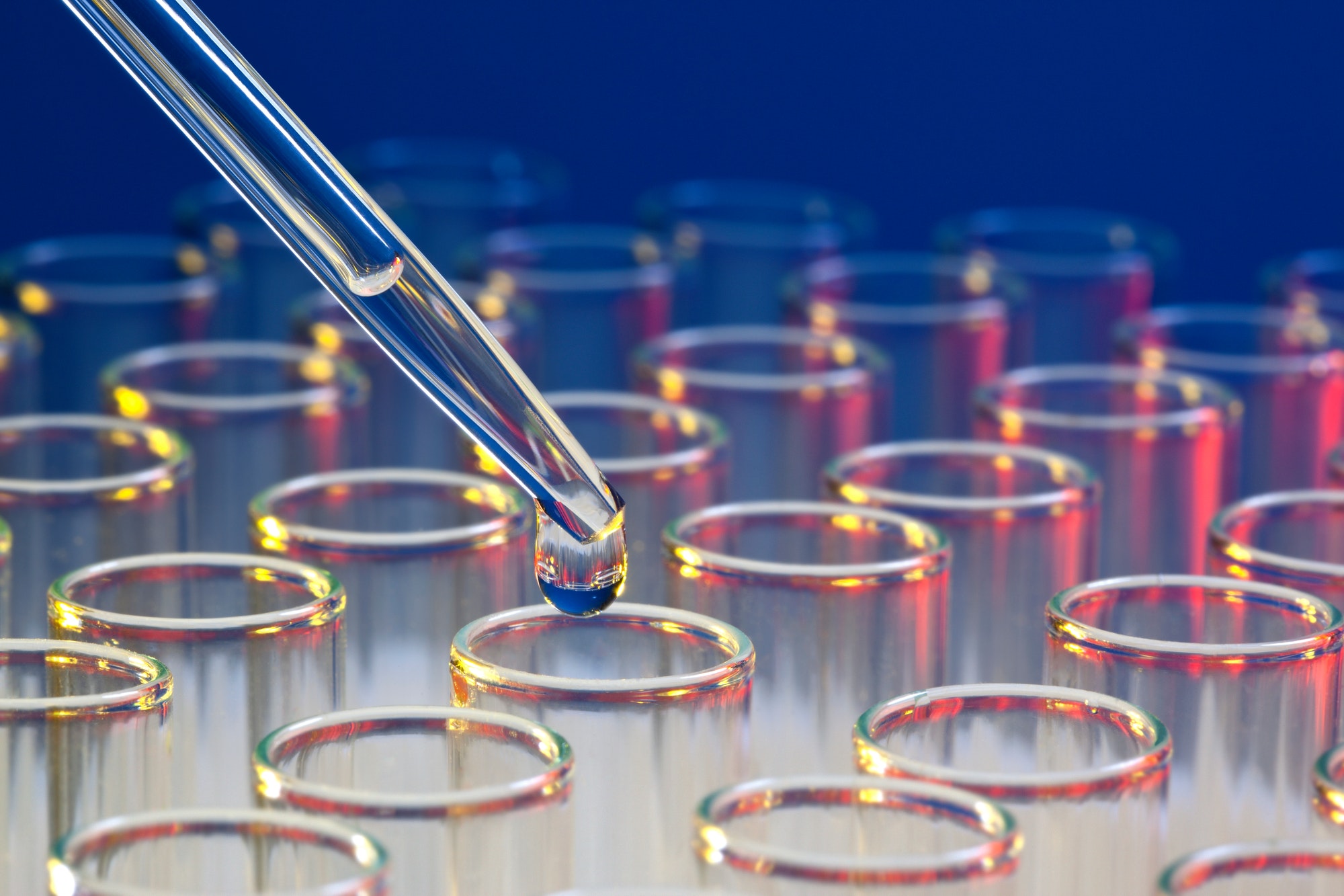 Des analyses, mais pourquoi ? - ahuney